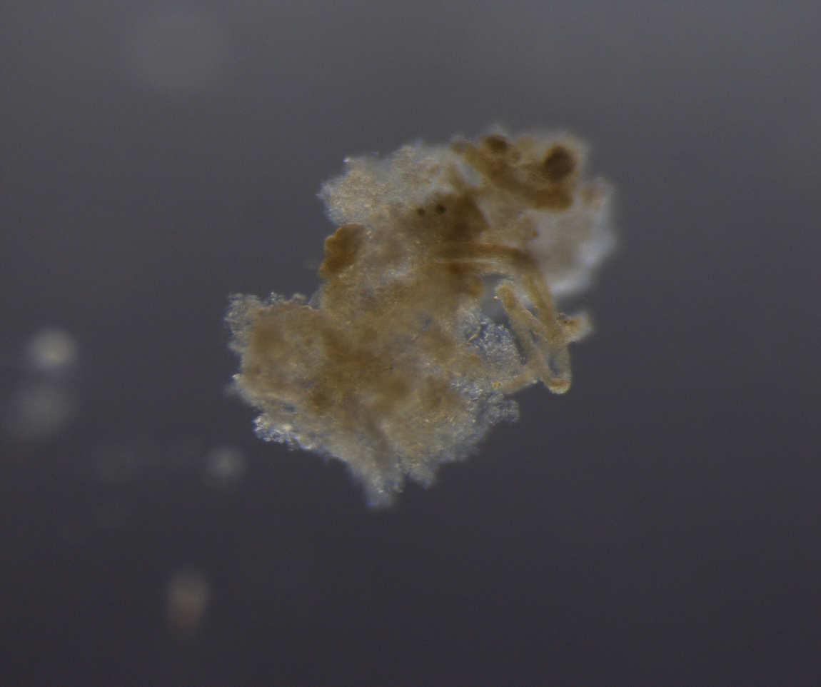Marine snow provides new clues about the export of carbon to the deep ...